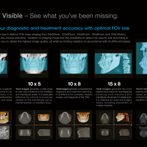 PreXion Excelsior – Navtech Practice Solutions