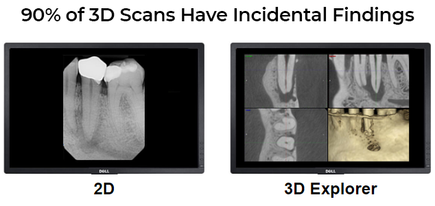 Why Navtech’s Team of Dental Imaging Experts Chose The PreXion Explorer – Navtech Practice Solutions