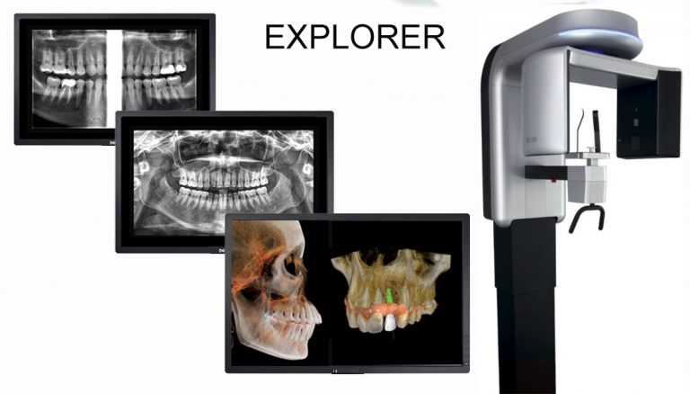 Why Navtech’s Team of Dental Imaging Experts Chose The PreXion Explorer – Navtech Practice Solutions
